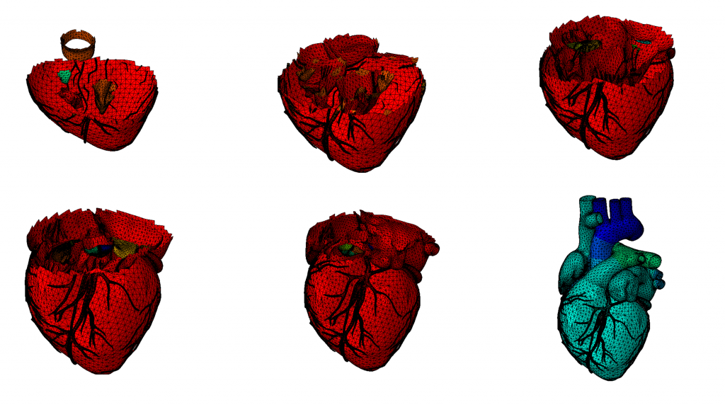 3D Bio-Printing of Full Size Model of Humun Heart - Advance Engineering ...