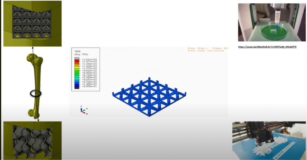 Digital Healing: Numerical Simulation of 3D Printed Magnesium Bone ...